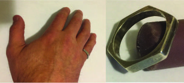 Chemist’s Ring | Association of the Chemical Profession of British Columbia